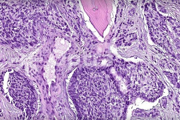 Digital Pathology Scanners & Solution Provider - OptraSCAN