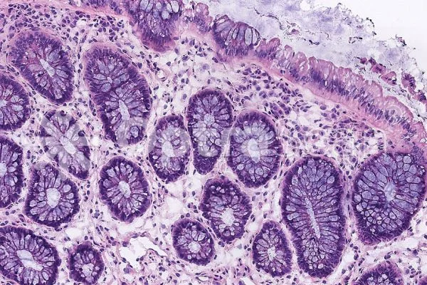 Digital Pathology Scanners | Digital Slide Scanners – OptraSCAN