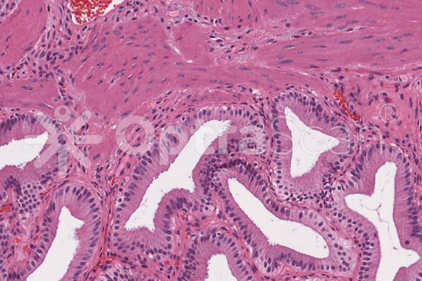 Digital Pathology Scanners & Solution Provider - OptraSCAN