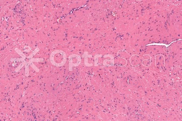 Digital Pathology Scanners | Digital Slide Scanners – OptraSCAN