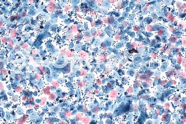 Digital Pathology Scanners & Solution Provider - OptraSCAN