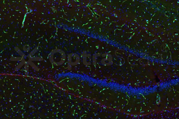 Digital Pathology Scanners & Solution Provider - OptraSCAN