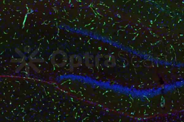 Digital Pathology Scanners | Digital Slide Scanners – OptraSCAN