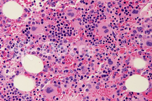 Digital Pathology Scanners & Solution Provider - OptraSCAN