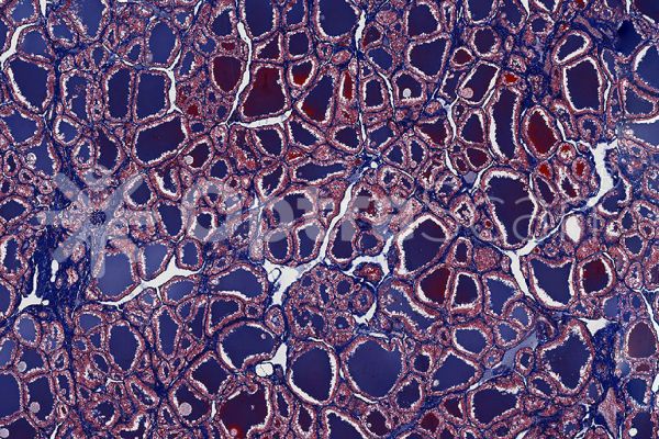 Digital Pathology Scanners & Solution Provider - OptraSCAN