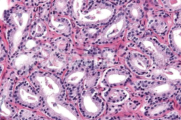 Digital Pathology Scanners | Digital Slide Scanners – OptraSCAN