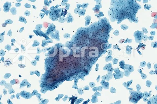 Digital Pathology Scanners | Digital Slide Scanners – OptraSCAN