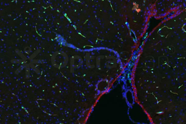 Digital Pathology Scanners | Digital Slide Scanners – OptraSCAN