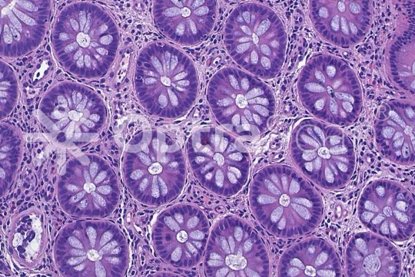 Digital Pathology Scanners | Digital Slide Scanners – OptraSCAN