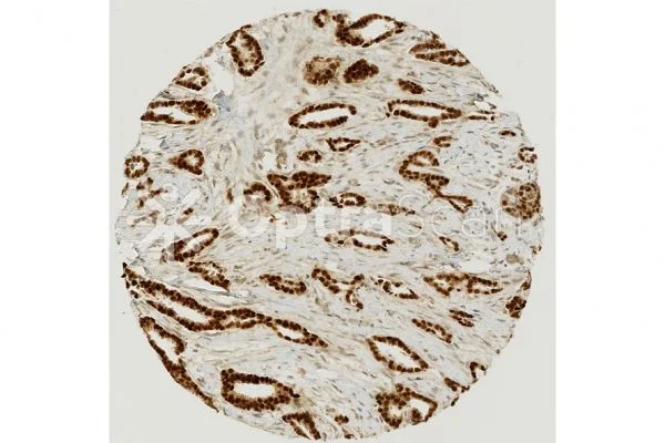 Digital Pathology Scanners | Digital Slide Scanners – OptraSCAN