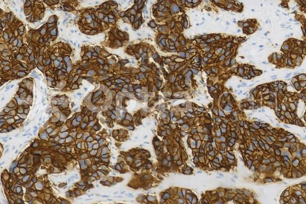 Digital Pathology Scanners | Digital Slide Scanners – OptraSCAN