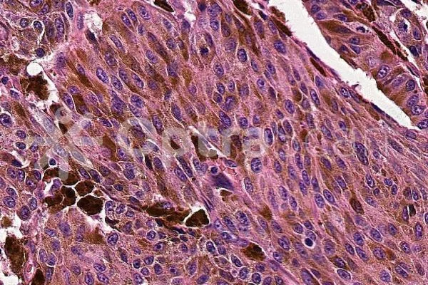 Digital Pathology Scanners | Digital Slide Scanners – OptraSCAN