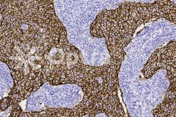 Digital Pathology Scanners | Digital Slide Scanners – OptraSCAN