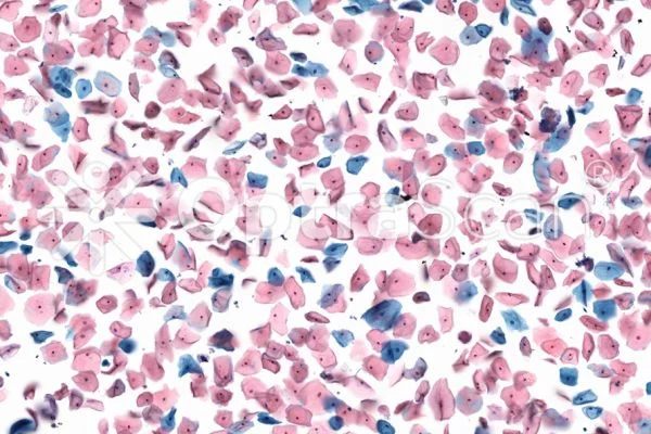 Digital Pathology Scanners | Digital Slide Scanners – OptraSCAN