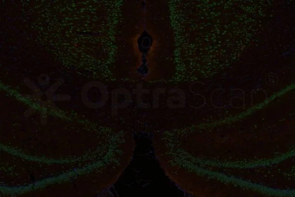 Digital Pathology Scanners | Digital Slide Scanners – OptraSCAN