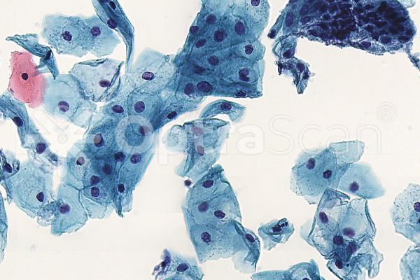 Digital Pathology Scanners & Solution Provider - OptraSCAN