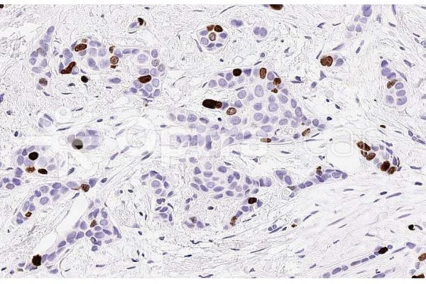 Digital Pathology Scanners | Digital Slide Scanners – OptraSCAN