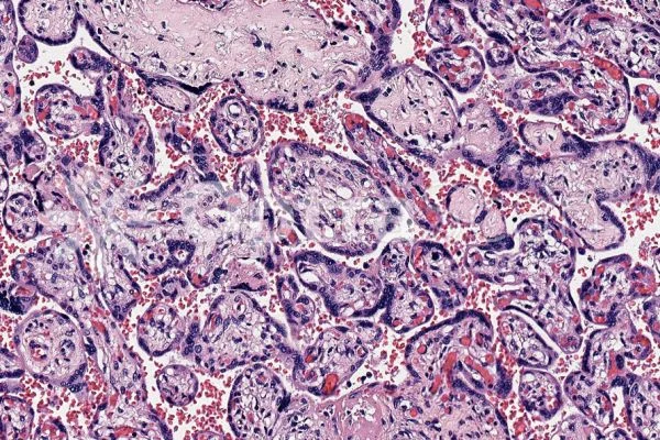 Digital Pathology Scanners | Digital Slide Scanners – OptraSCAN