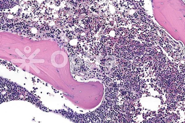 Digital Pathology Scanners | Digital Slide Scanners – OptraSCAN