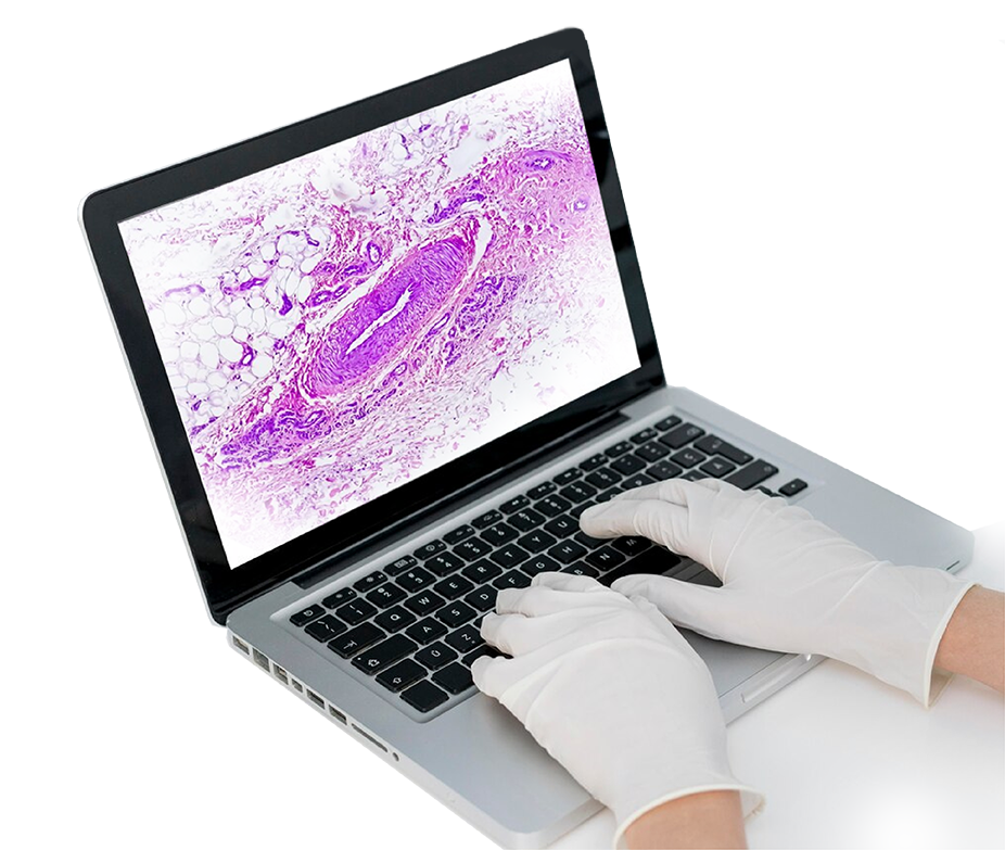 A Complete Overview of Digital Histopathology: Advancing Diagnostic ...
