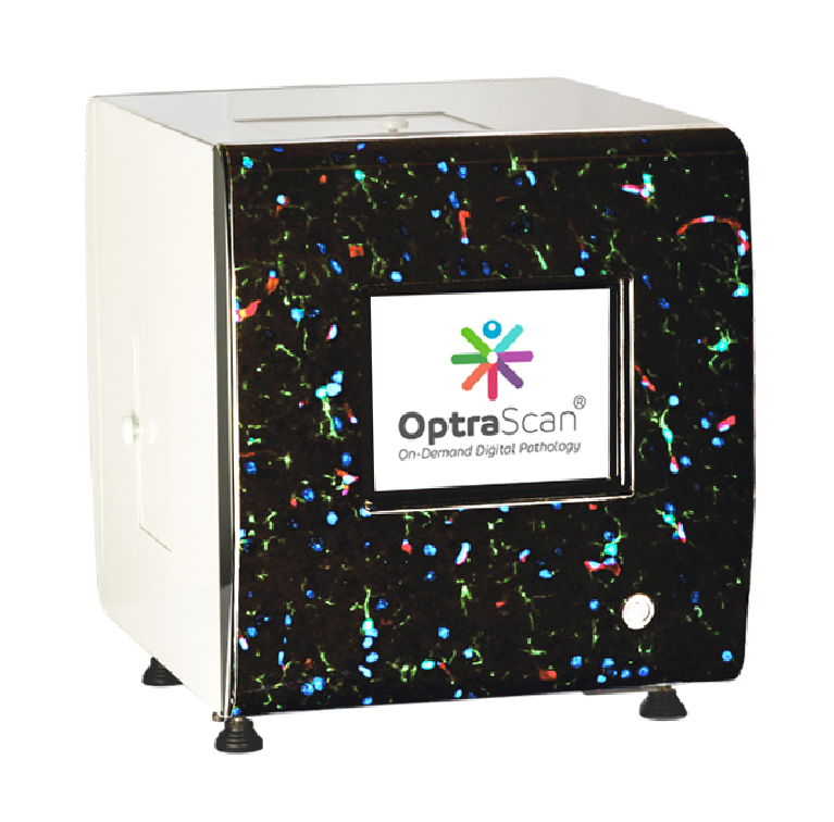 The Power of Multiplex Staining in the Precision Diagnosis of Cancer