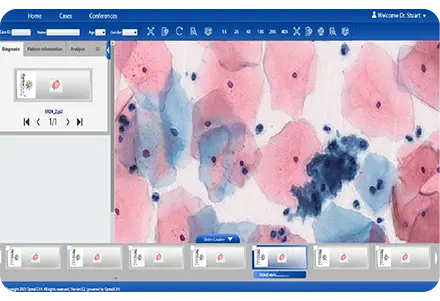 Digital Pathology Scanners | Digital Slide Scanners – OptraSCAN
