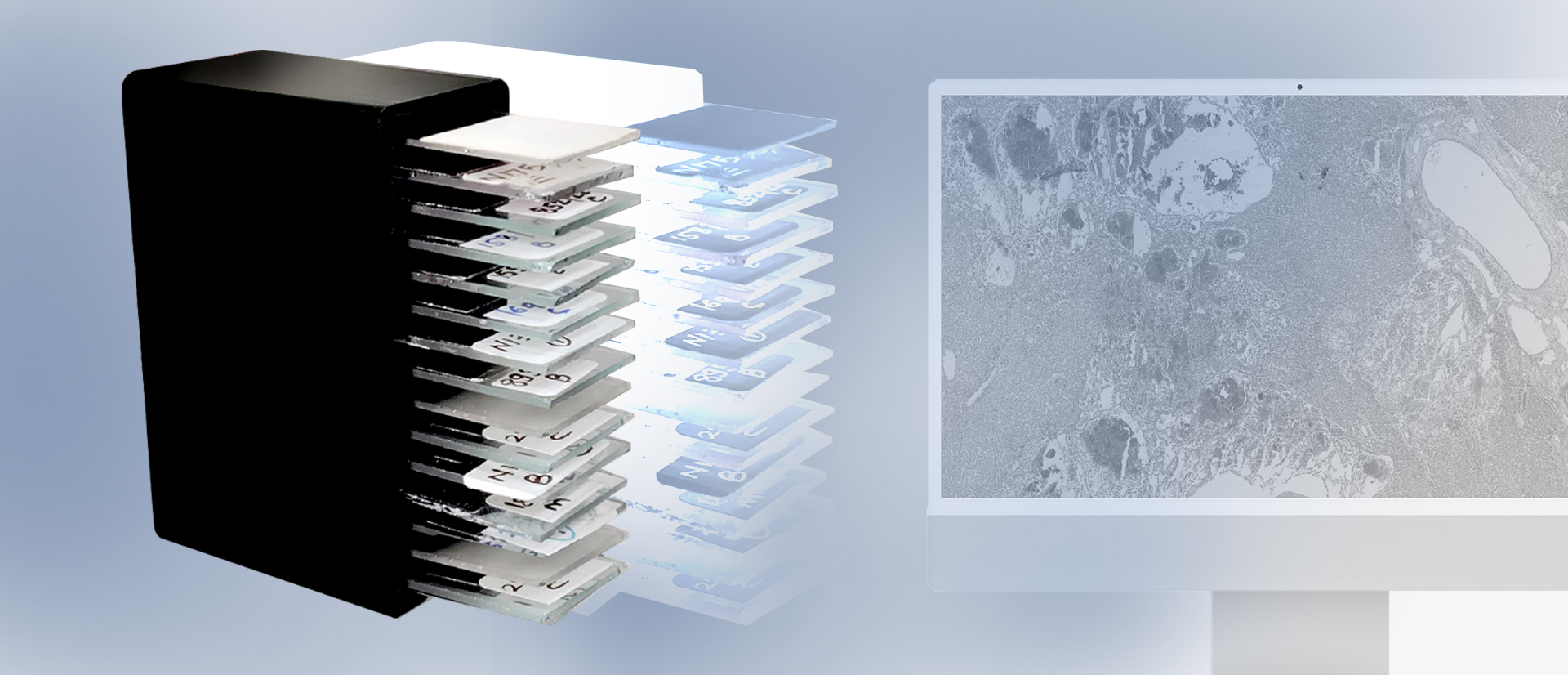 Digital Pathology | OS-FS Frozen Section Scanner