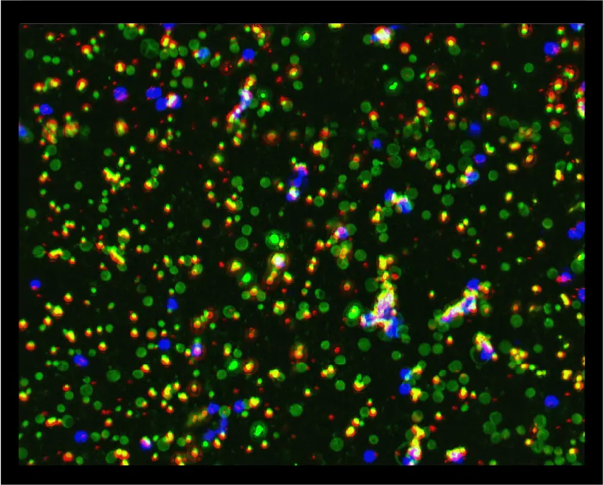 Fluorescence Slide Scanner | Fluorescence Scanning - OptraSCAN